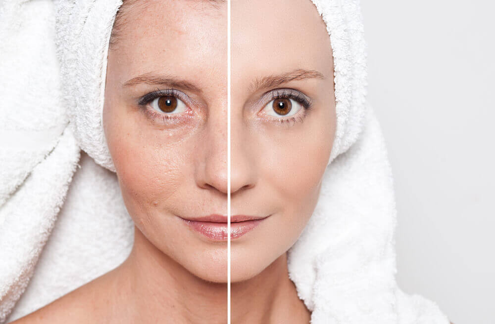 Wrinkle Reduction - Luminous Dermatology